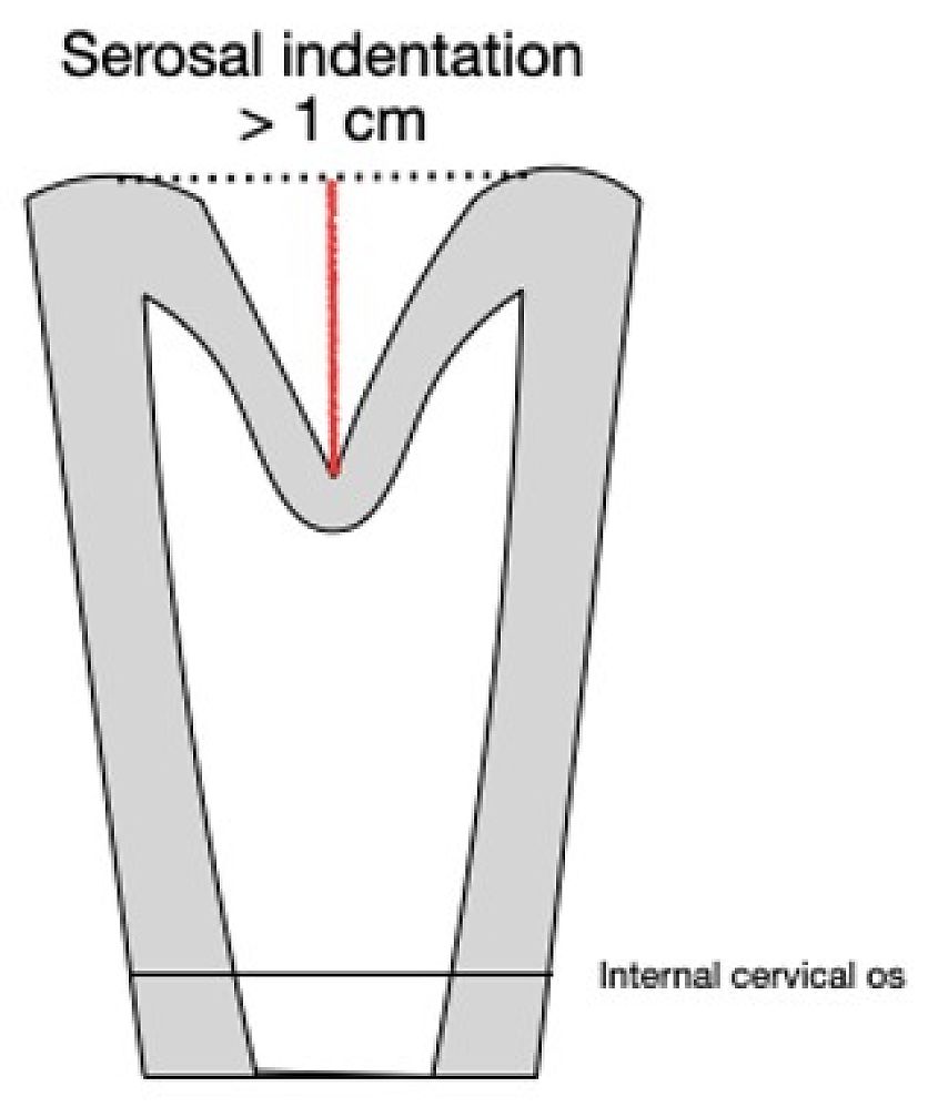 Serosa Of Uterus Color